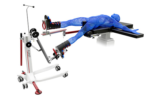 PURIST Orthopedic Leg Positioner | STERIS