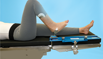 TKR Surgery Positioner | STERIS